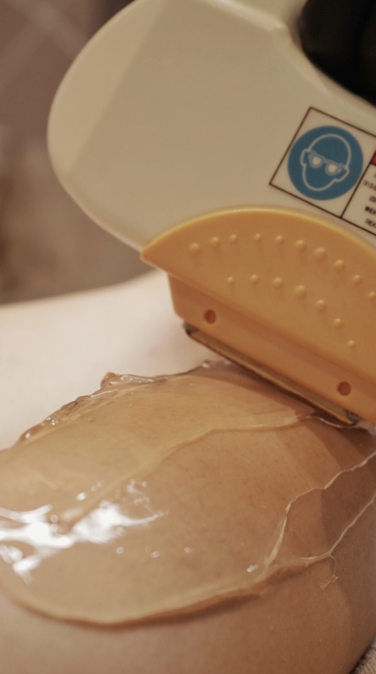 Supplément SIF IPL - Pour Femme - ESTHETIQUE A'CORPS PARFAIT